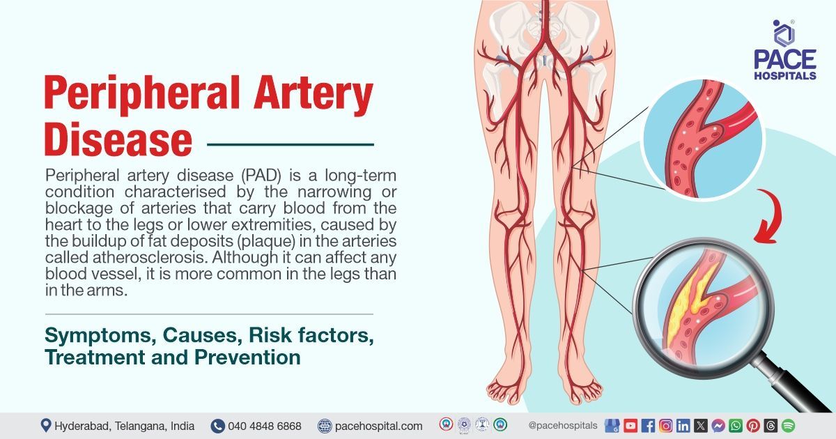 Blocked artery in leg symptoms store